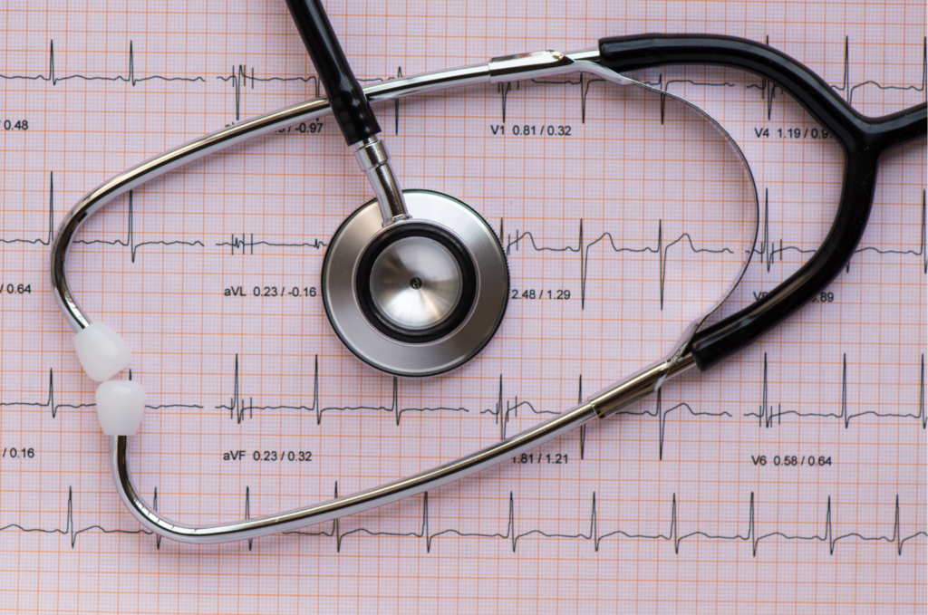 ECG - Cardiologist Perth WA | Access Cardiology