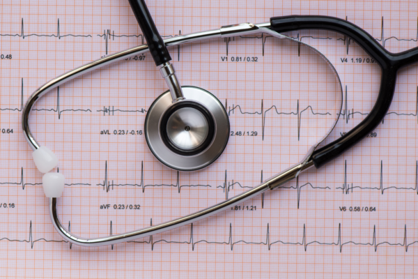ECG - Cardiologist Perth WA | Access Cardiology